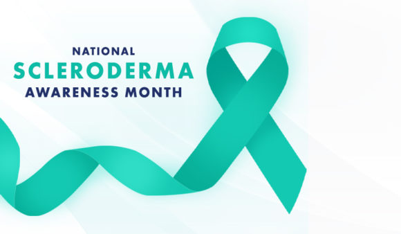 National Scleroderma Awareness Month - Vital Imaging